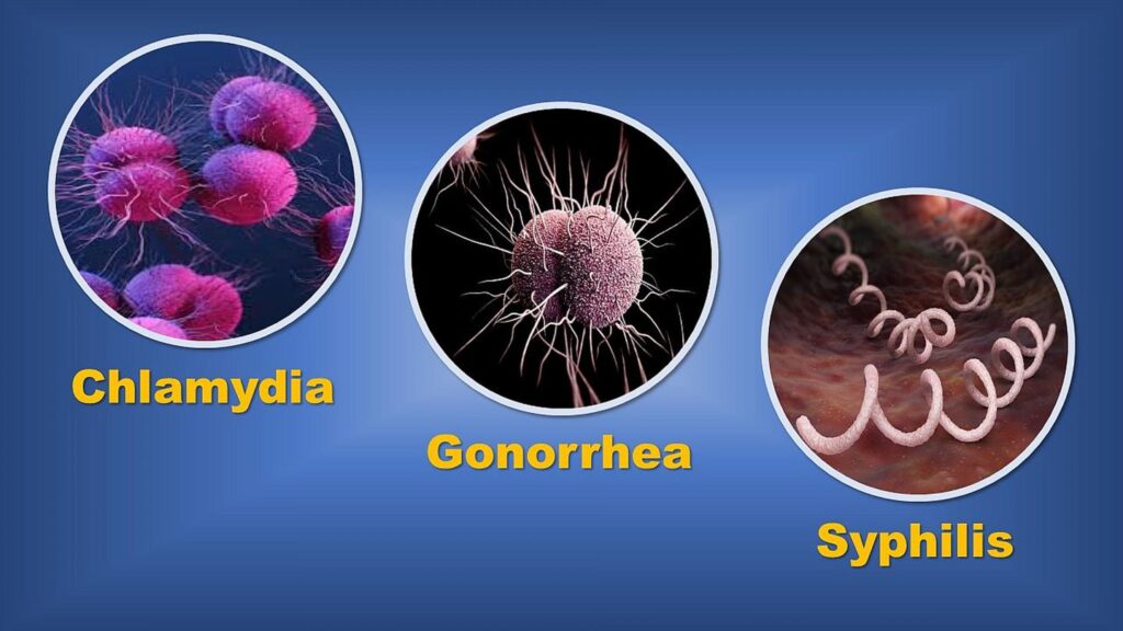 Sexually Transmitted Diseases (STDs) And It's Prevention | Science Vision